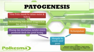 Pengenalan mengenai penyakit polio pada anak dan balita | PPTX
