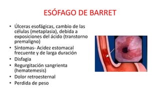 1._CAVIDAD_BUCAL_GLÁNDULAS_SALIVALES_Y_ESÓFAGO[1].pdf
