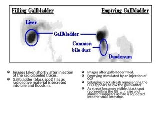 1. Gall bladder and Biliary Disease (3).ppt