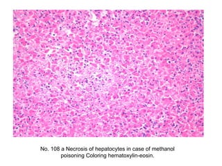 1. Necrosis tissue in pathoanatomy in medical science .ppt