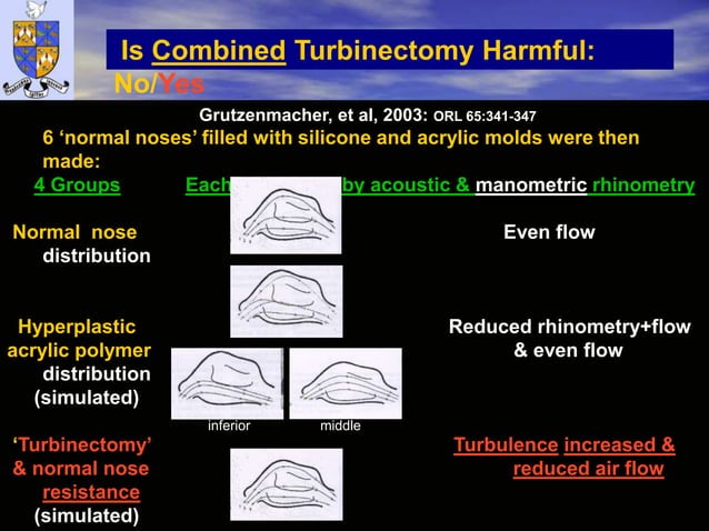 Role for Turbinectomy In the Crowded Nasal Airway, Is Empty Nose ...