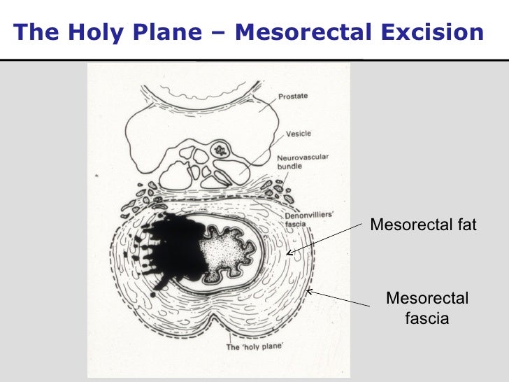BALKAN MCO 2011 - D. Sebag-Montefiore - Imaging and local therapy of