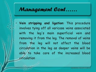 varicose vein | PPT
