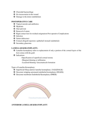 eye bank by optom faslu muhammed | PDF