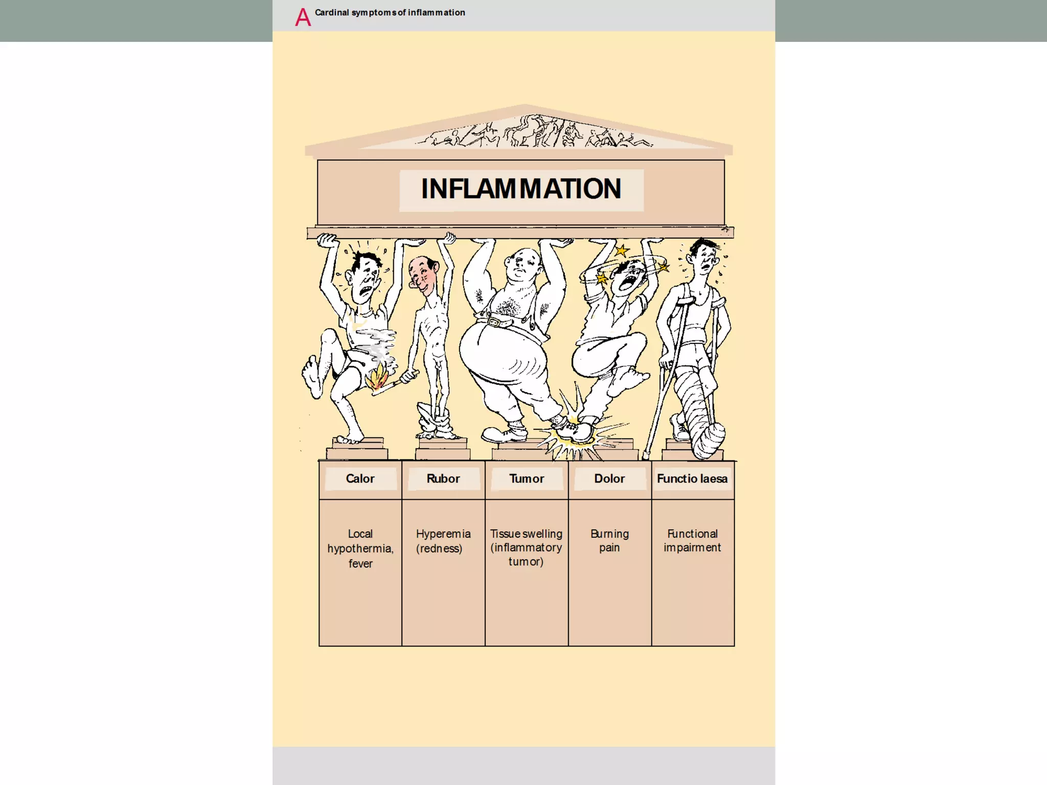 Inflammation Pathomorphology.pdf | Diseases and Conditions | Medical Health