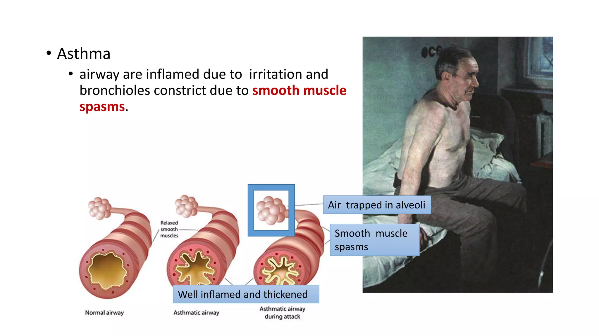 1-4syndromes in Disorders of the Respiratory .pptx