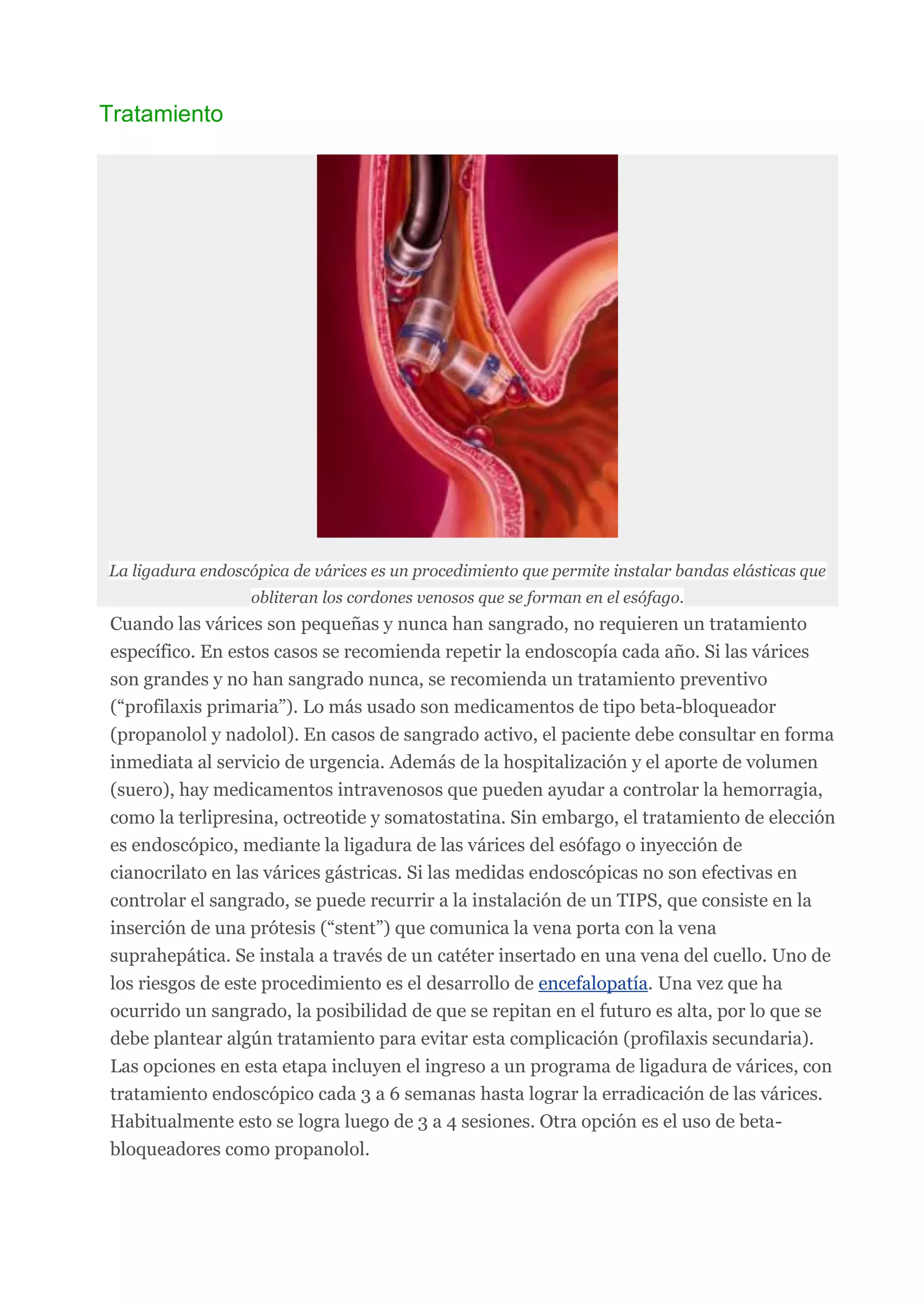 1.7 várices esofágicas | PDF