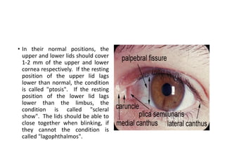 1-Anatomy-and embryology lecture of-the-EYE.pdf
