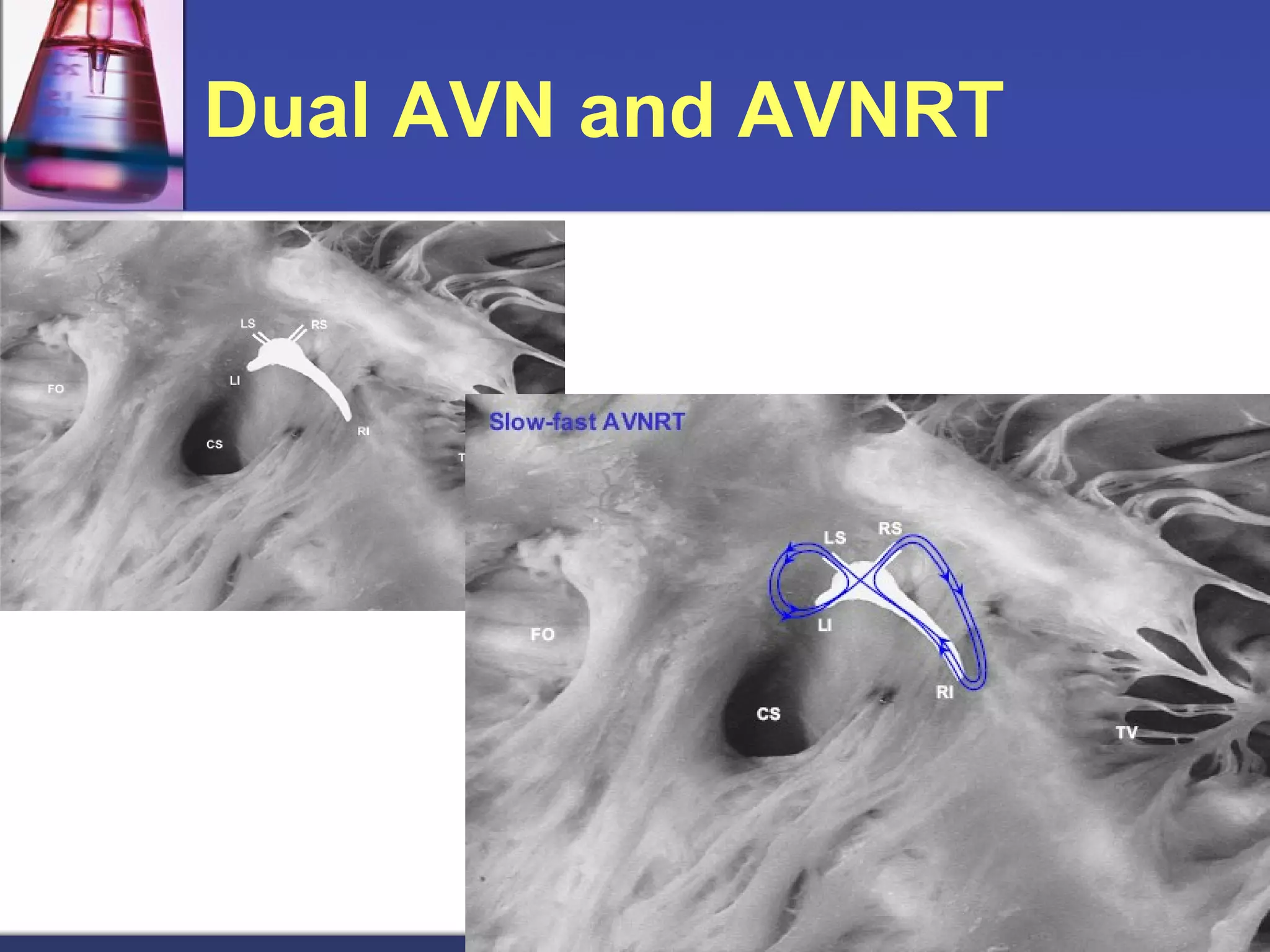 Anatomy of Cardiac Conduction System | PPT