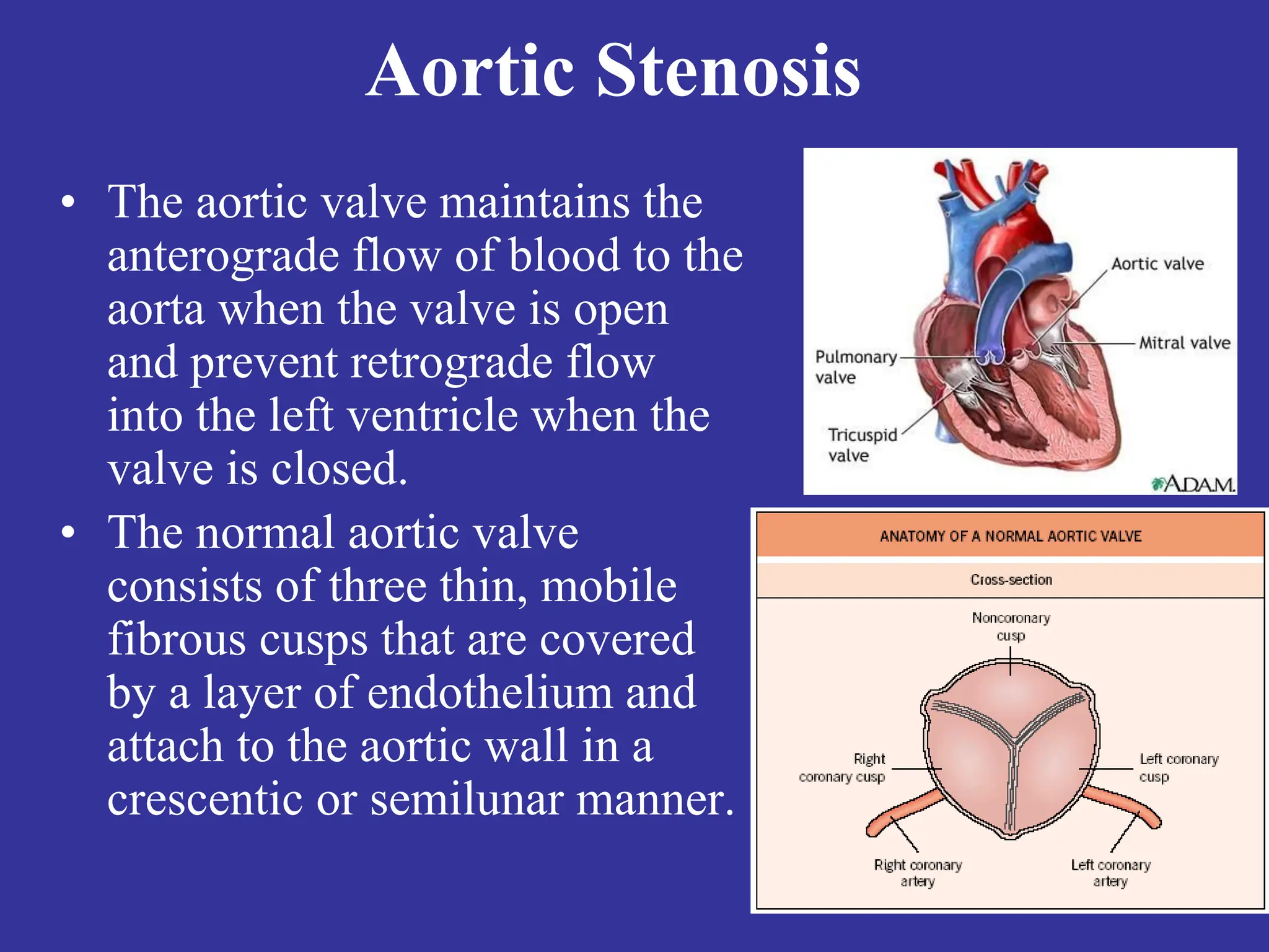1- Aortic Valve Diseases Cardiovascular Module | PDF