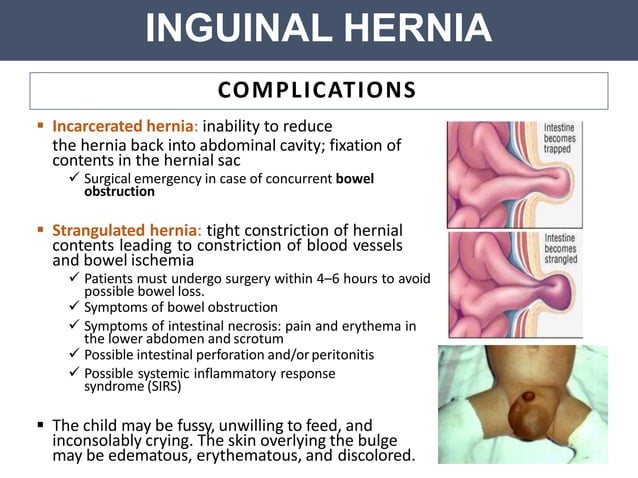 1 Approaches Inguinoscrotal Abdominal Wall Disorders