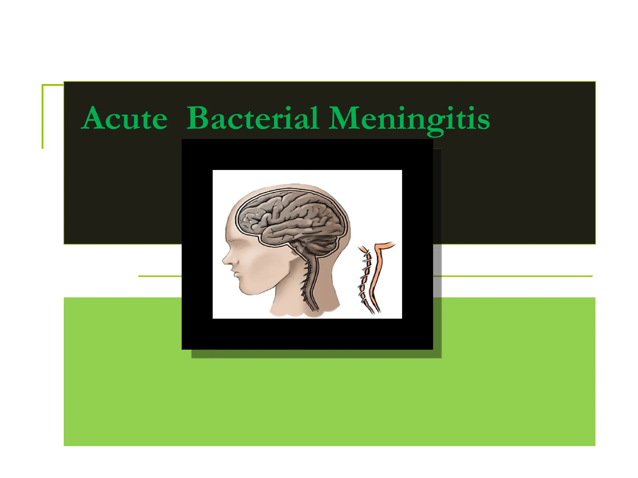 1-bacterial meningitis.ppt for medical student | PPT