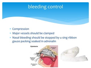 1-Basic principle for the management of maxil0facial injuries.pdf