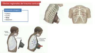 Biomecánica del trauma | PPTX
