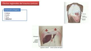 Biomecánica del trauma | PPTX