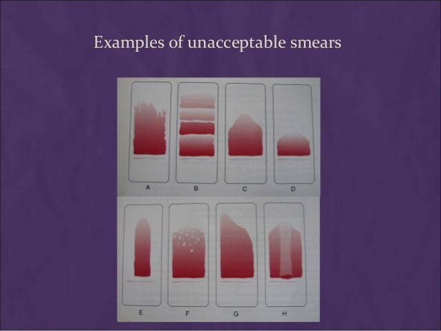 1 blood-smear