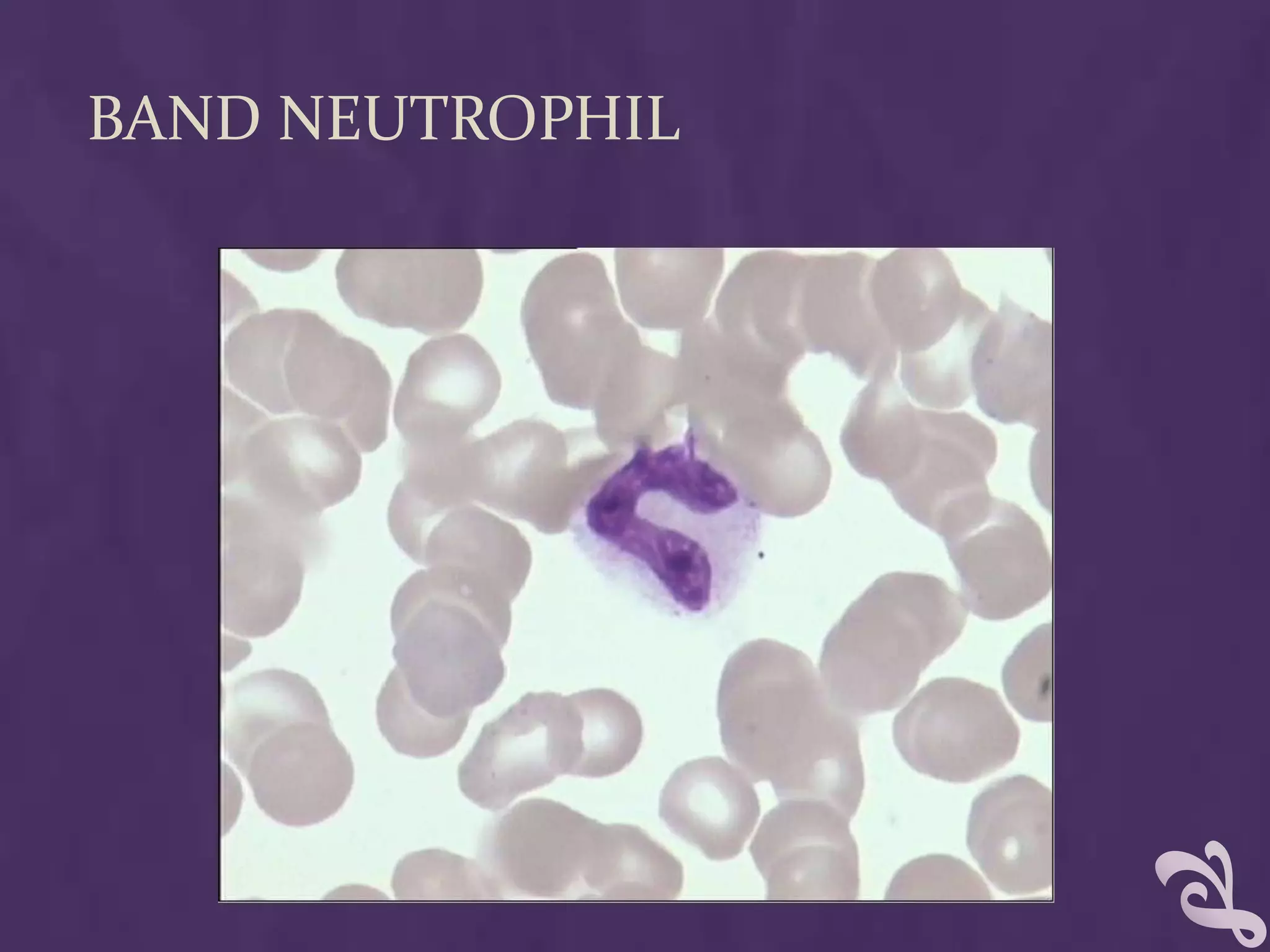 PERIPHERAL SMEAR EXAMINATION | PPT