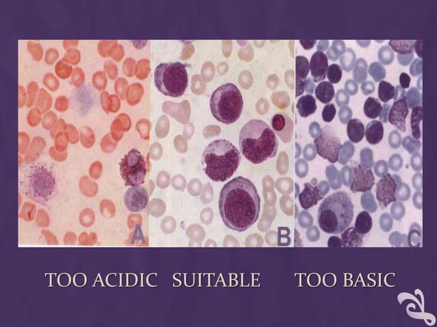 PERIPHERAL SMEAR EXAMINATION | PPT