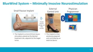 BlueWind Medical | PPTX