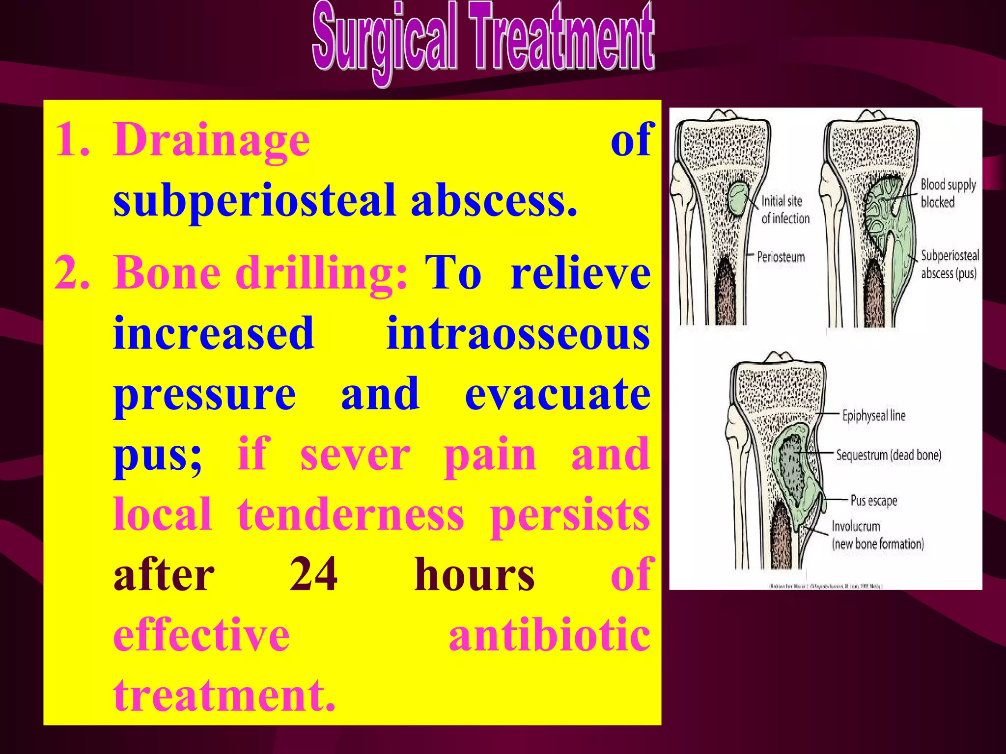 Bone and Joint Infection | PPT