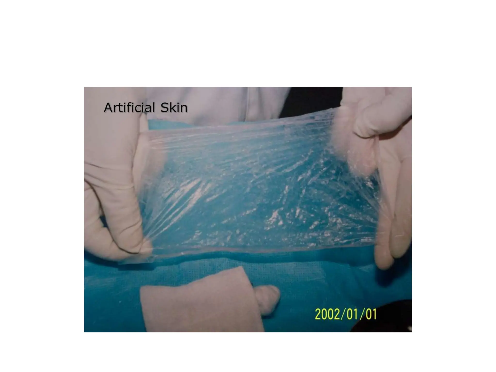 1-BURN of skin and tissue and muscles and bone | PPT