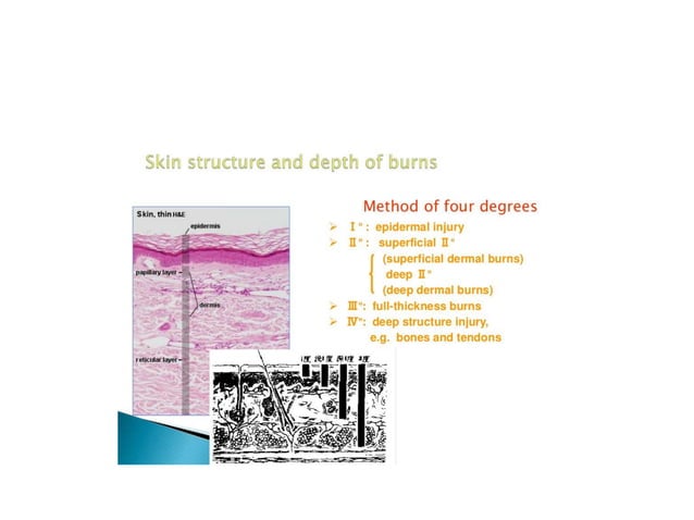 1-BURN of skin and tissue and muscles and bone | PPT