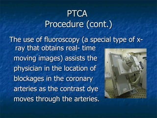 Doppler Ultrasound, PTCA, Cardiac Enzyme Studies | PPT | Heart and ...