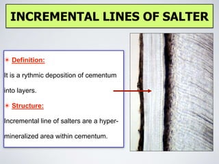 1 cementum | PPT