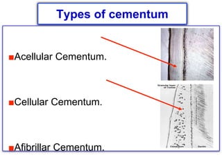 1 cementum | PPT