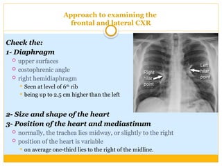 1-Chest imaging- Armstrong (2).ppsx...... | PPSX