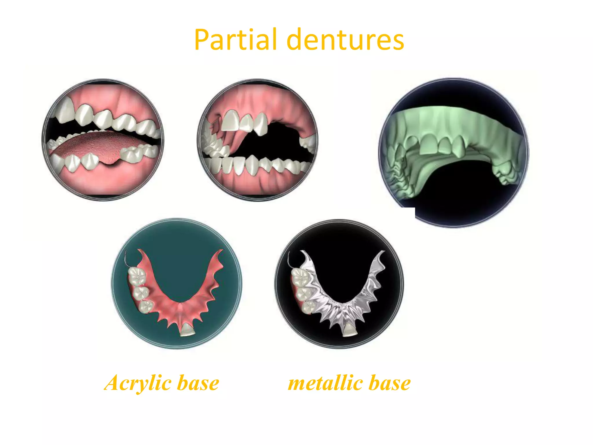 1-CLASSIFICATION OF RPD 1 copy.pptx