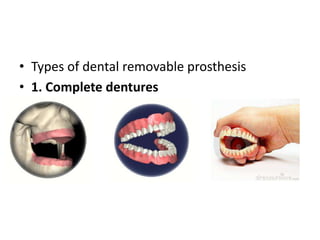 1-CLASSIFICATION OF RPD 1 copy.pptx