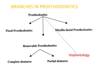 1-CLASSIFICATION OF RPD 1 copy.pptx