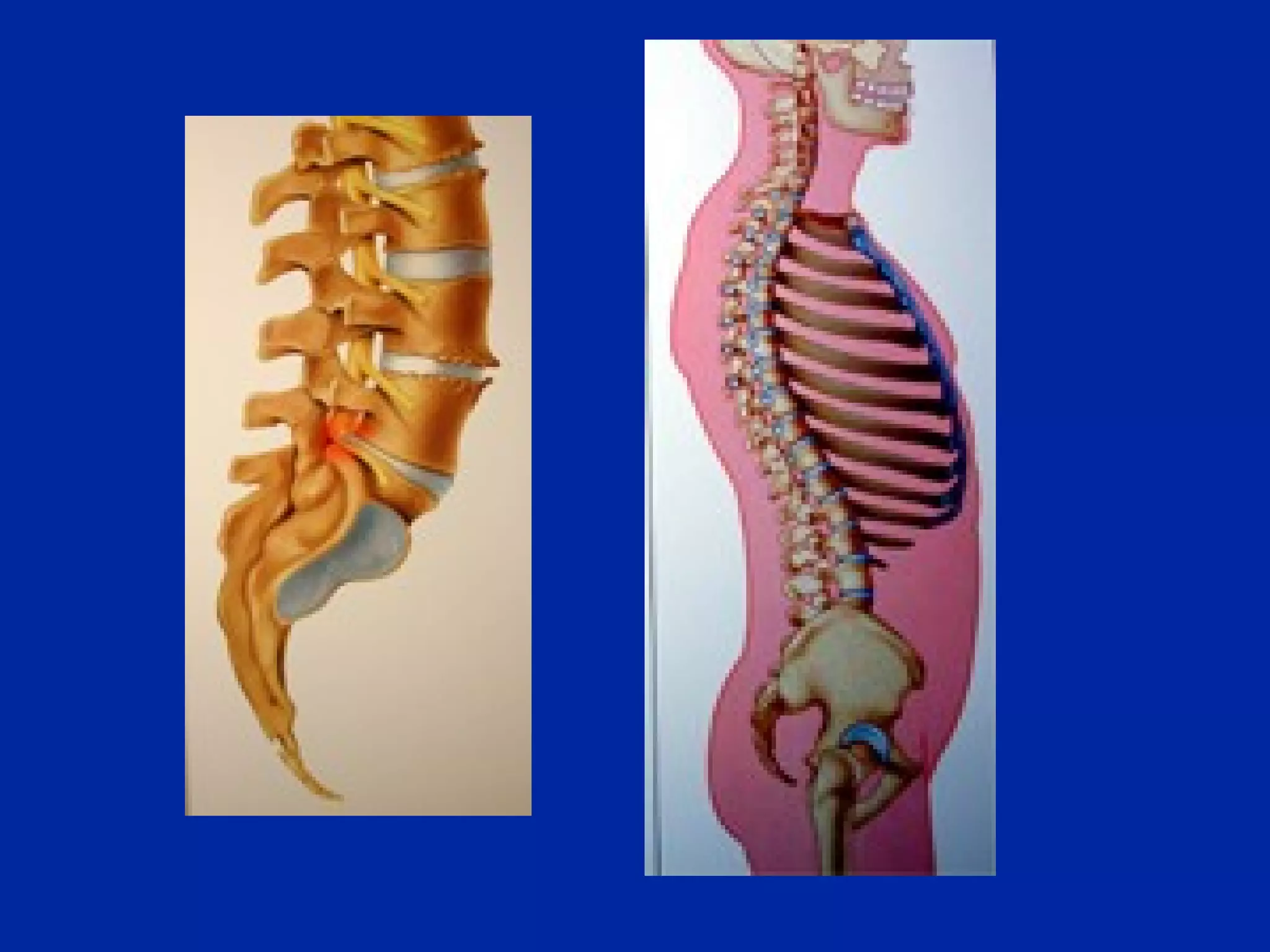 1 columna vertebral - generalidades | PPT