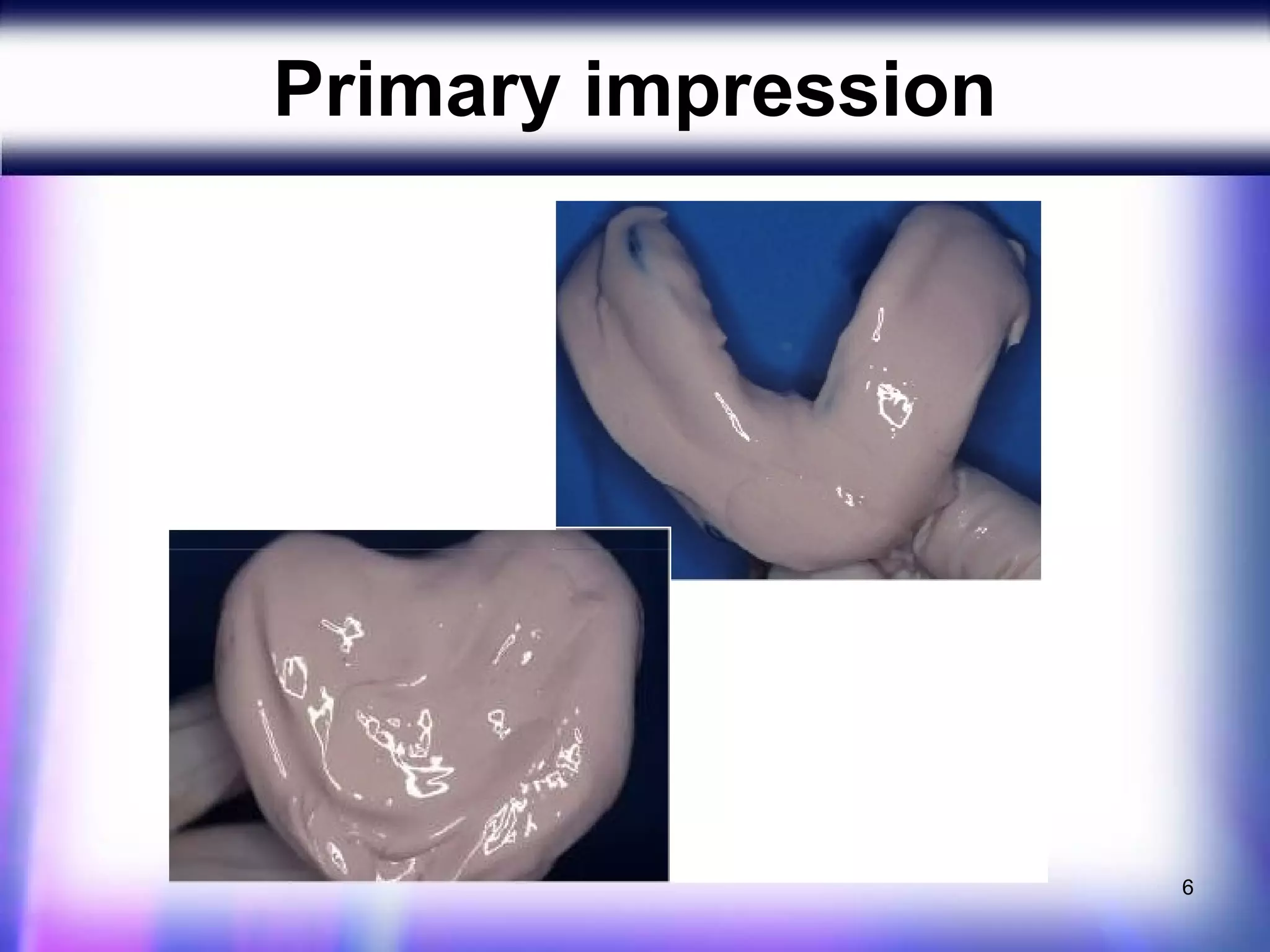 1.complete denture (power point) | PPT