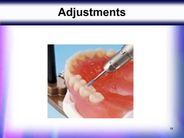 1.complete denture (power point) | PPT | Dental Health | Diseases and ...