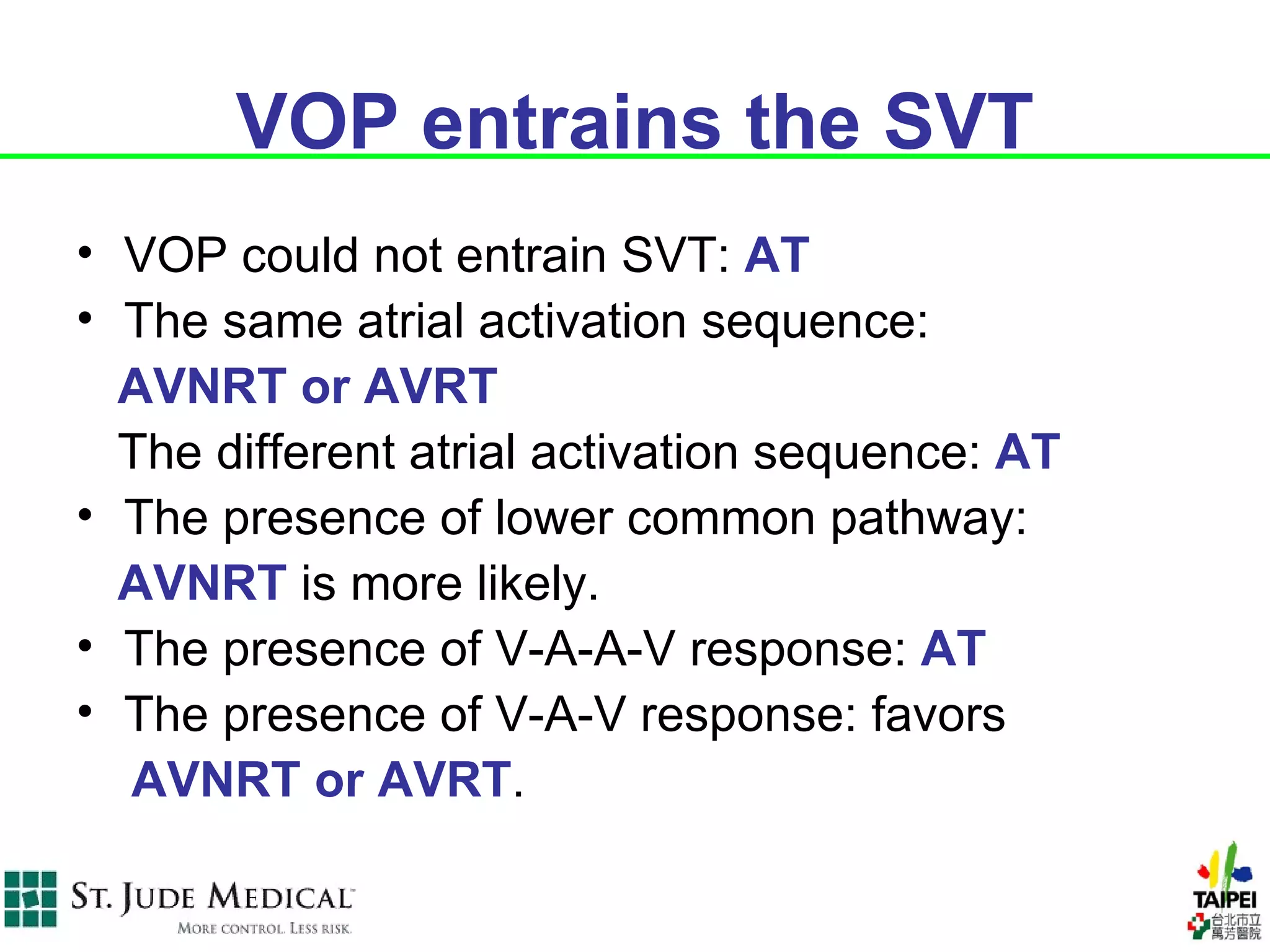 Complex svt with differentiation | PPT