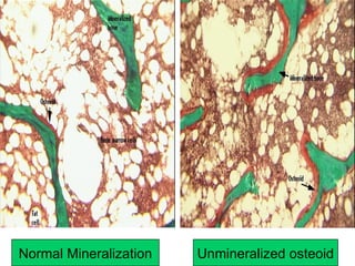 1- Congenital and aquired bone disease.pptx