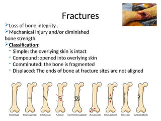 1- Congenital and aquired bone disease.pptx