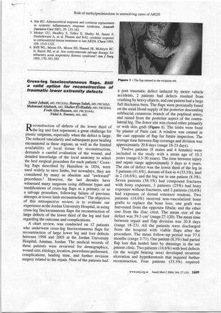 Cross-leg fasciocutaneous flaps.pdf