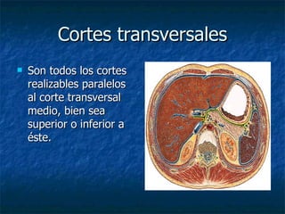 Corte Transversal Del Cuerpo