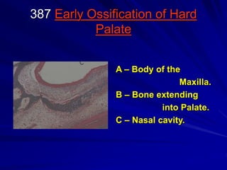 Development of Face & Oral cavity.ppt