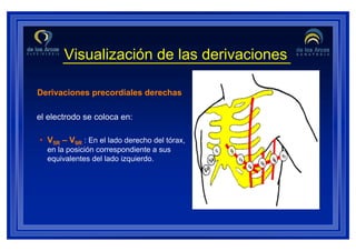 1. ecg 12_derivaciones_interpretación_esencial | PDF