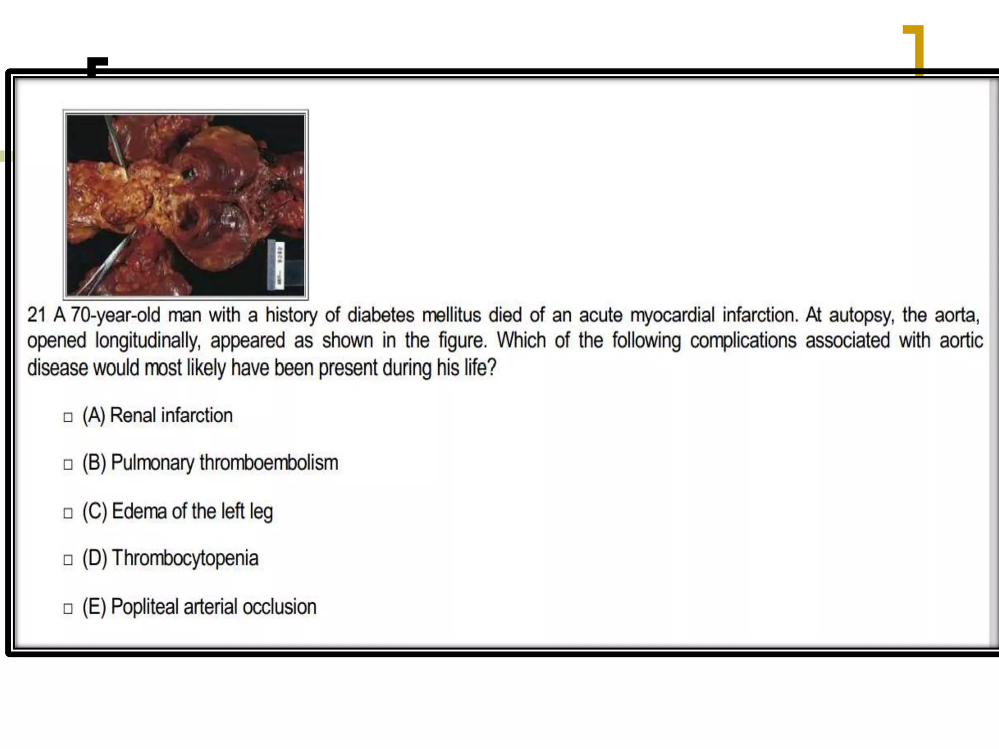 MCQs Hemodynamic Disorders, Thromboembolic Disease & Shock by DR ...