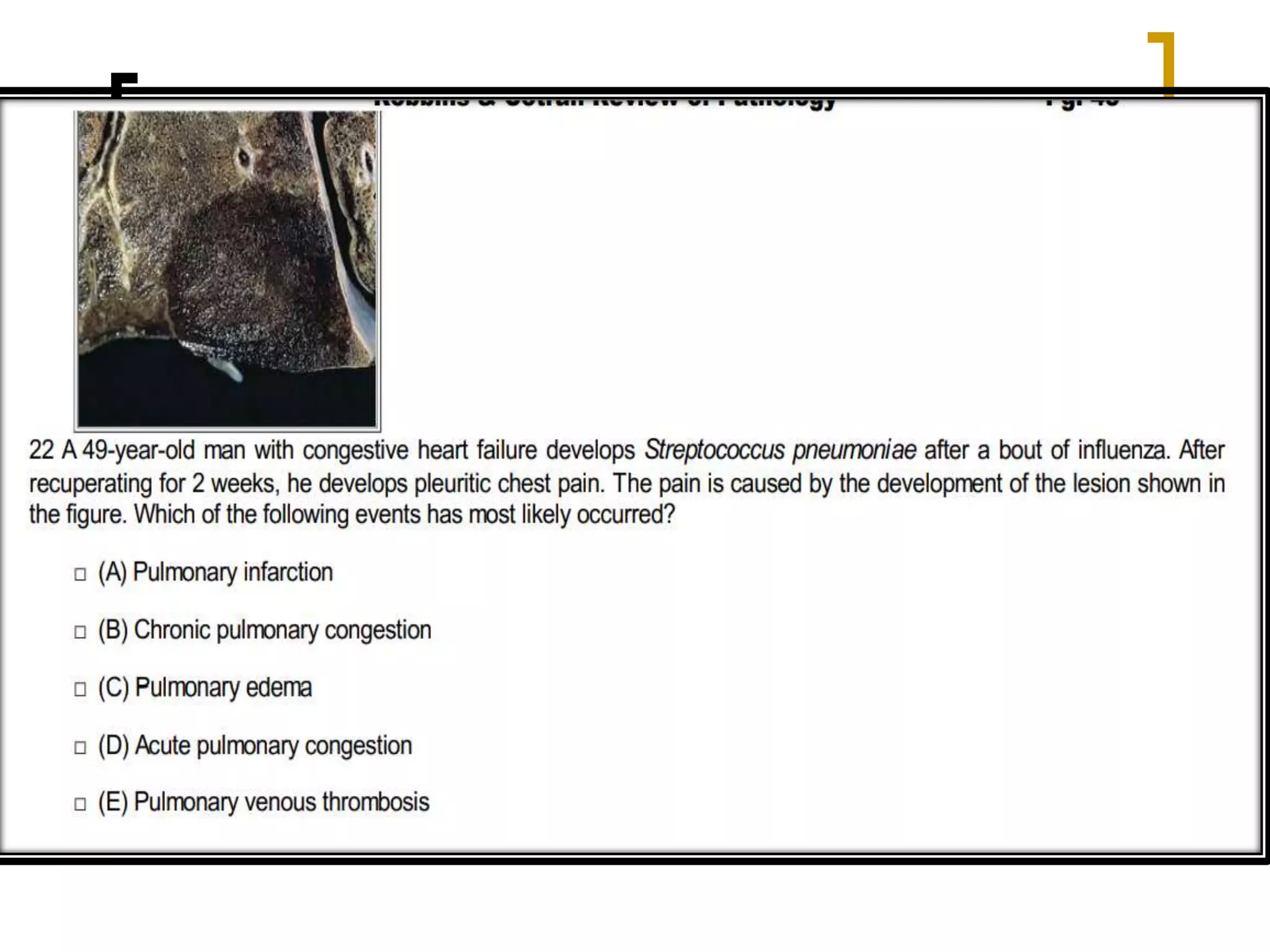 MCQs Hemodynamic Disorders, Thromboembolic Disease & Shock by DR ...