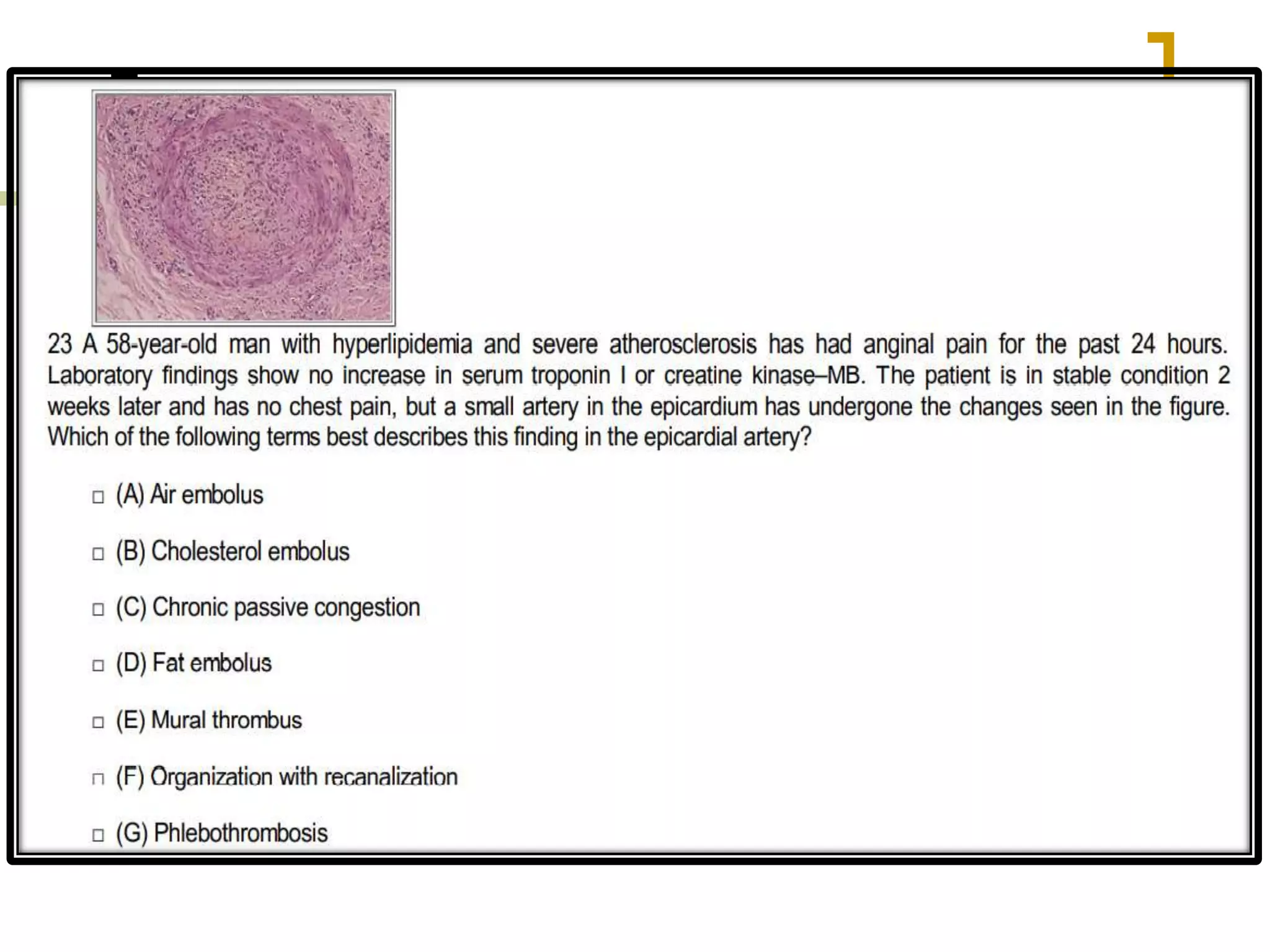 MCQs Hemodynamic Disorders, Thromboembolic Disease & Shock by DR ...