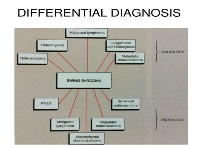Ewing's sarcoma | PPTX | Bone and Joint Conditions | Diseases and Conditions
