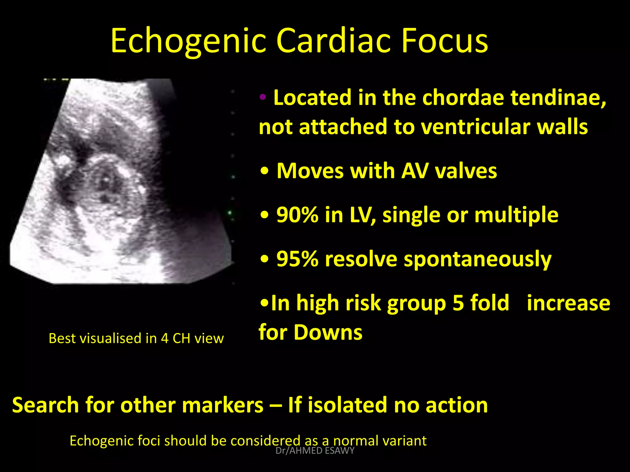 1-fetal genetic ultrasound Dr Ahmed Esawy | PDF