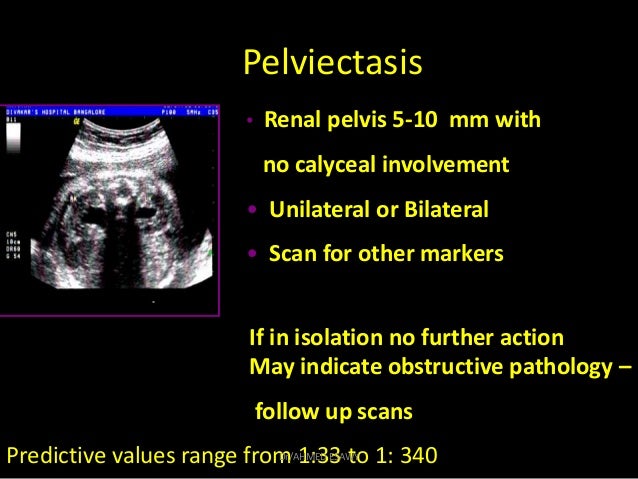 1-fetal genetic ultrasound Dr Ahmed Esawy