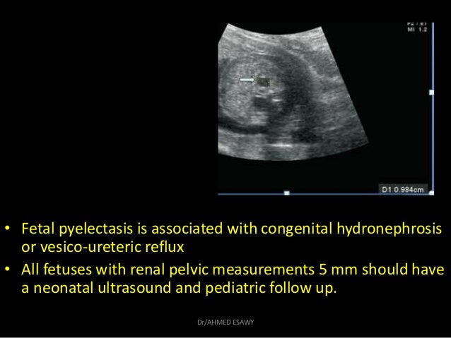 1-fetal genetic ultrasound Dr Ahmed Esawy